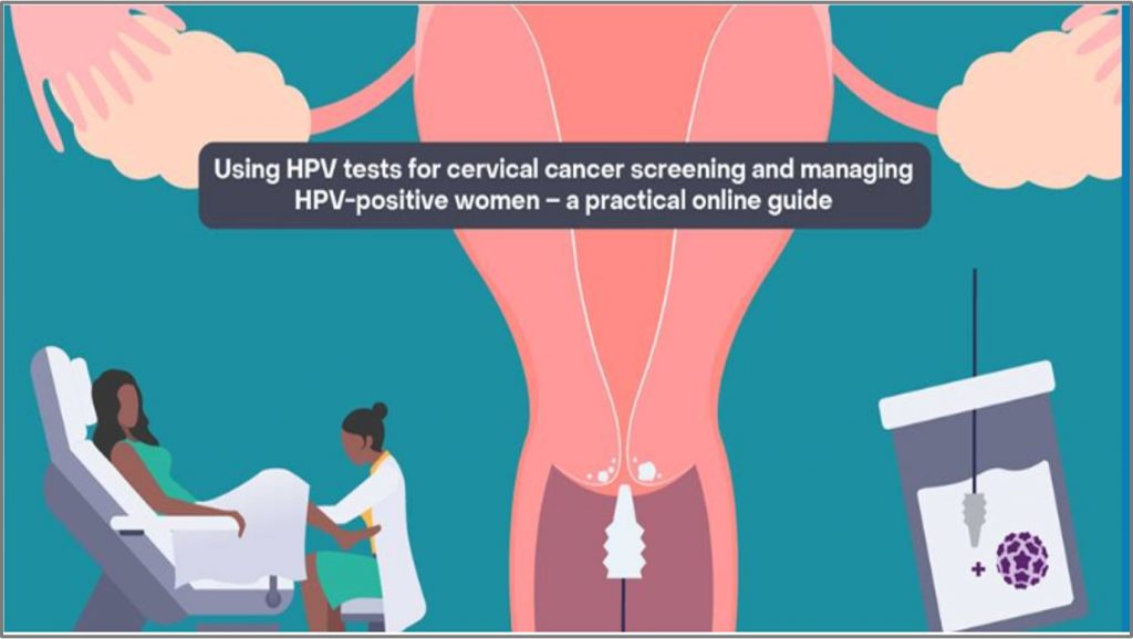 Usando testes de HPV para rastreamento de câncer cervical e ...
